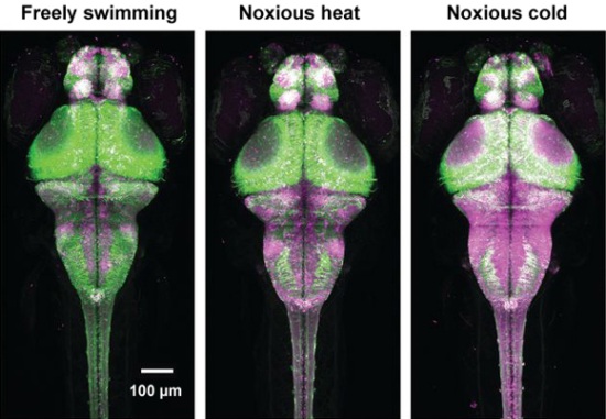 A Designed Protein Maps Brain Activity