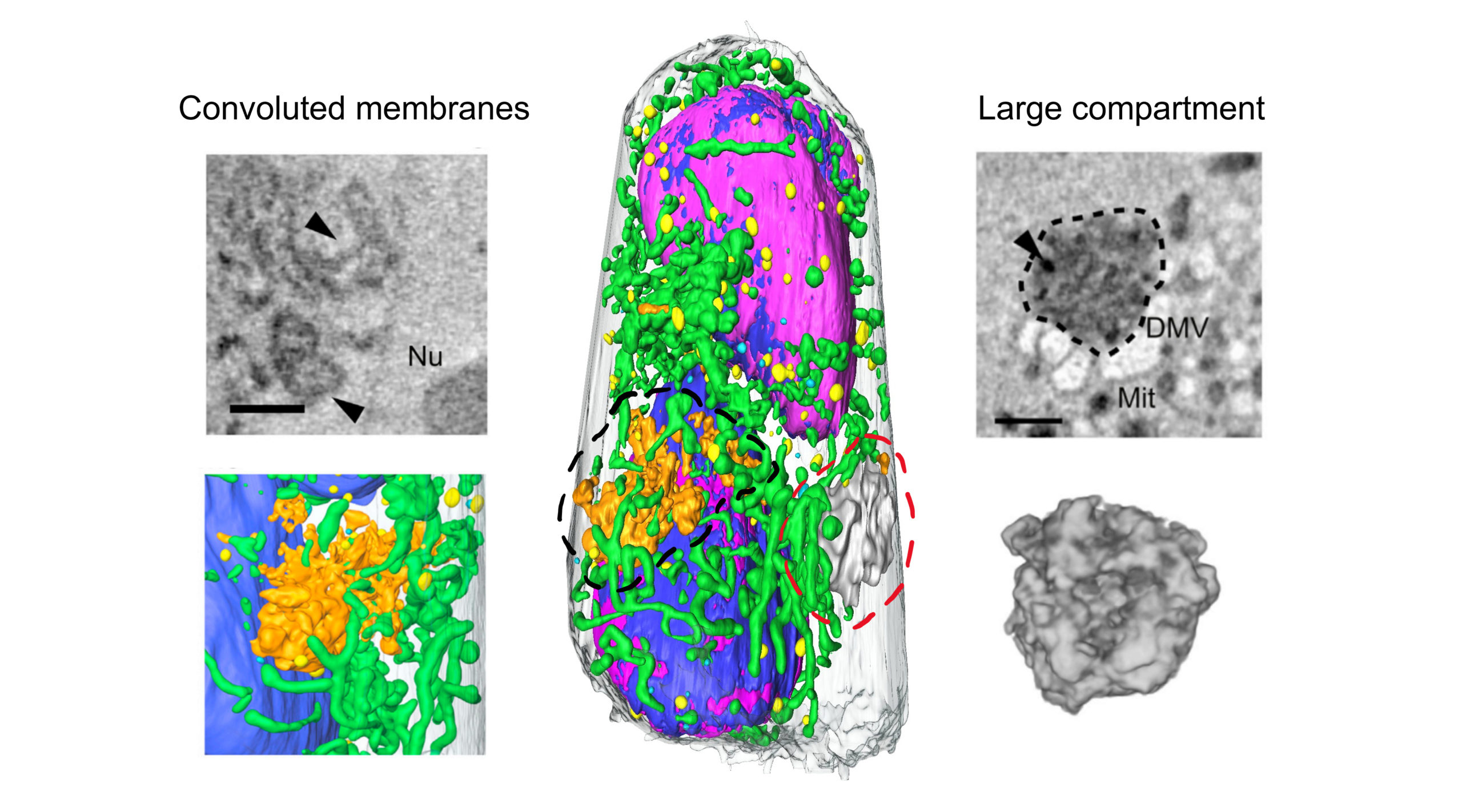 Rapid 3D Visualization of Lung Cells Altered by SARS-CoV-2