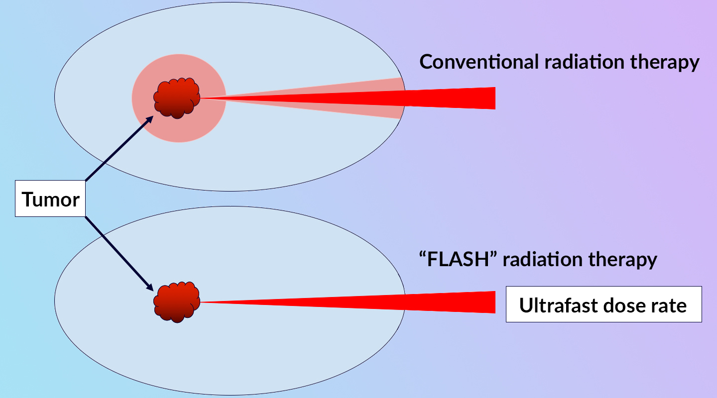 Clarifying the FLASH Effect for Cancer Radiation Therapy